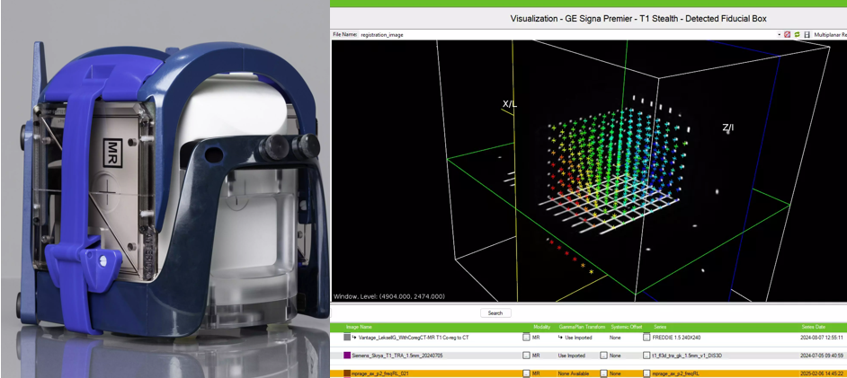 IBA launches QUASAR® GRID3D Advantage Image Distortion Analysis System | IBA Group